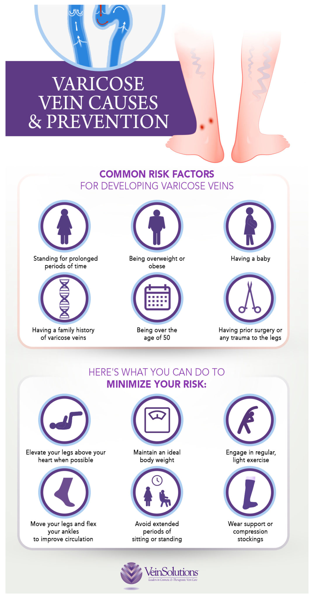 Are Varicose Veins Dangerous? | VeinSolutions Austin